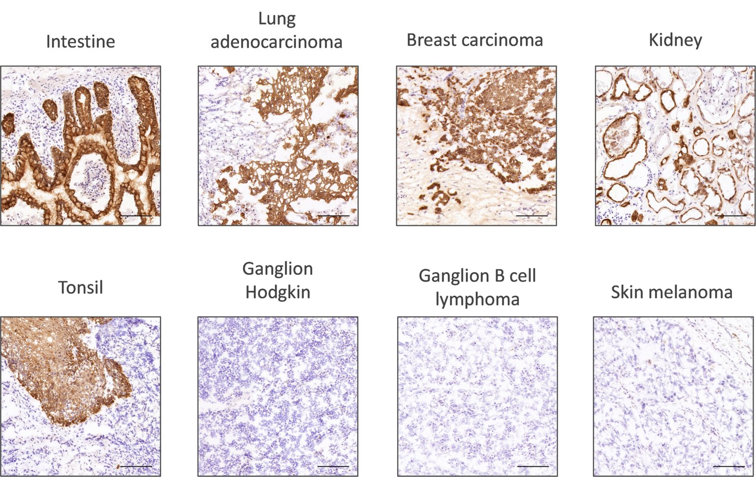 Antibody validation: innovative staining solutions to support your ...