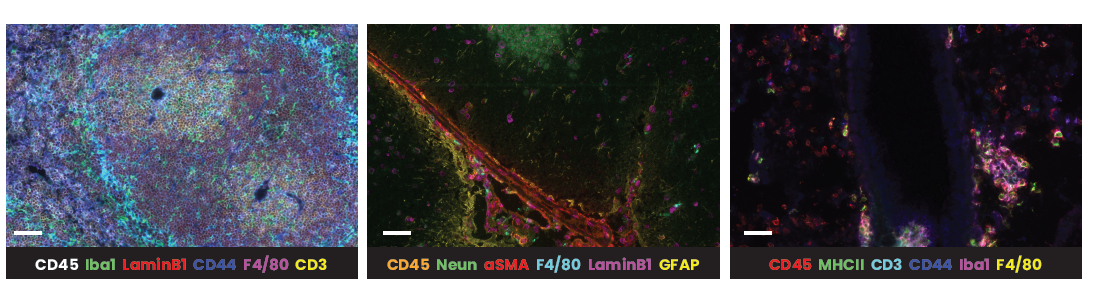 Hyperplex analysis on delicate frozen samples: now possible with high ...