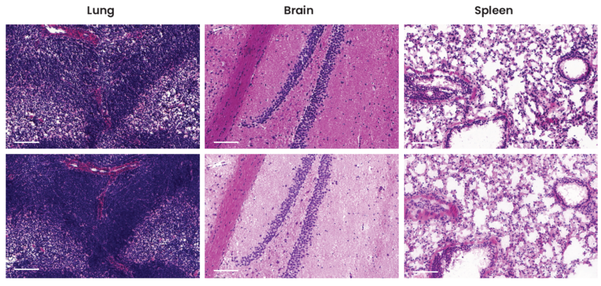 Hyperplex analysis on delicate frozen samples: now possible with high ...