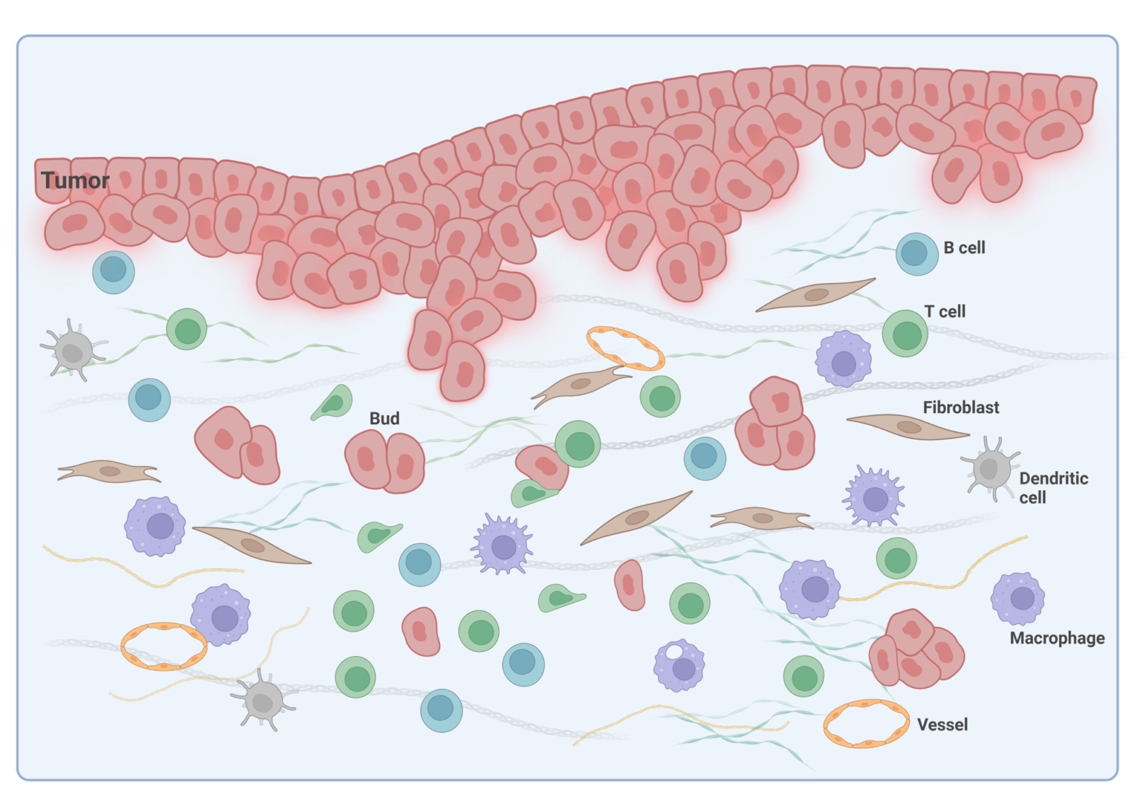 Deepening understanding of tumor budding in colorectal cancer for ...