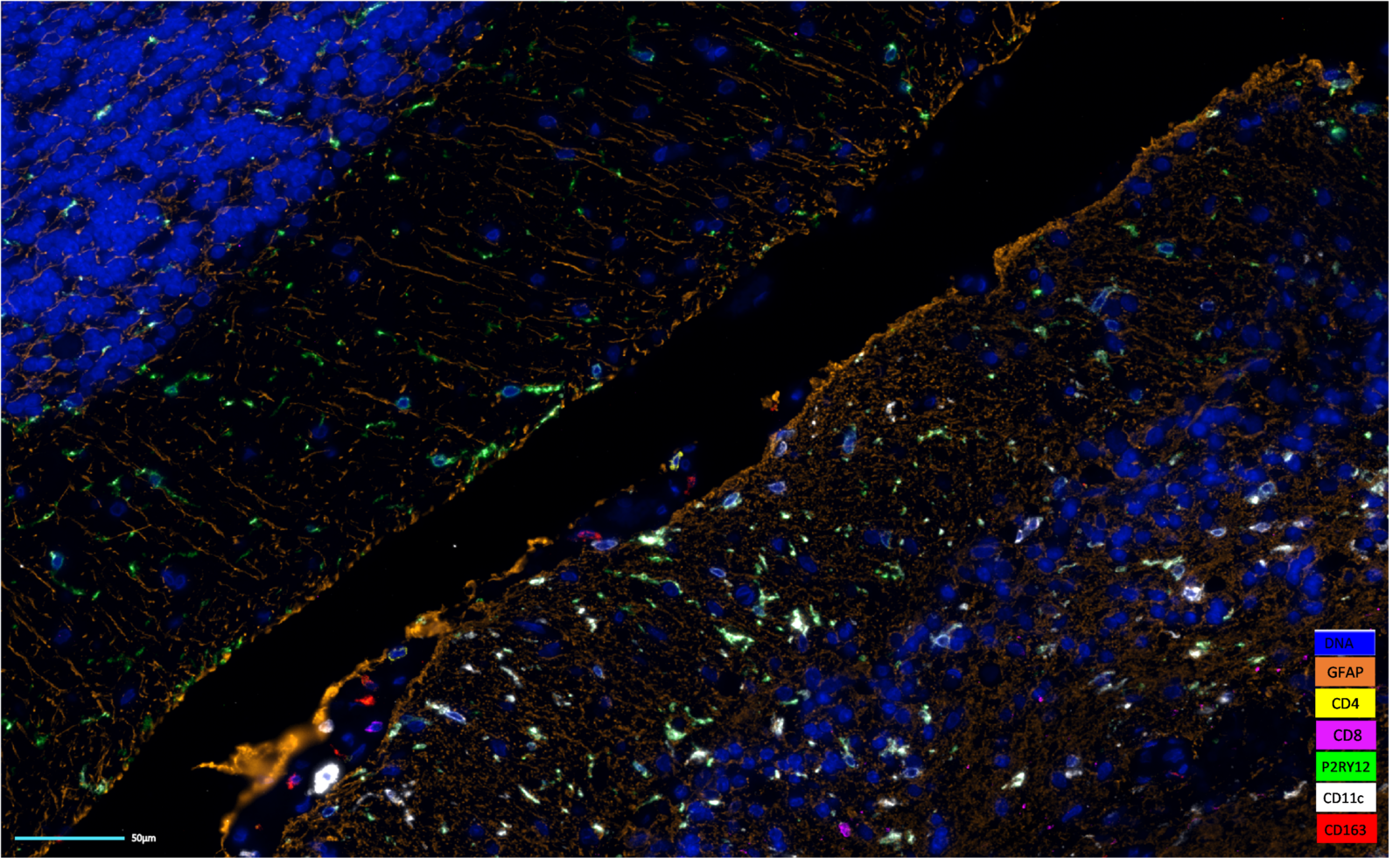Unraveling brain heterogeneity: exploring cellular diversity and ...