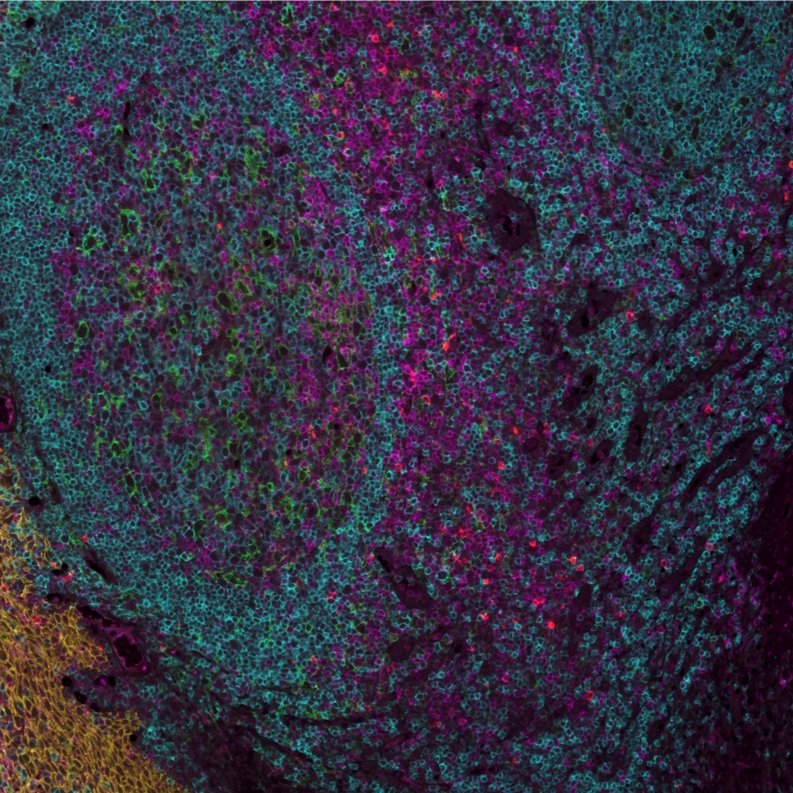 A high-plex road to biomarker development in a fully automated workflow ...