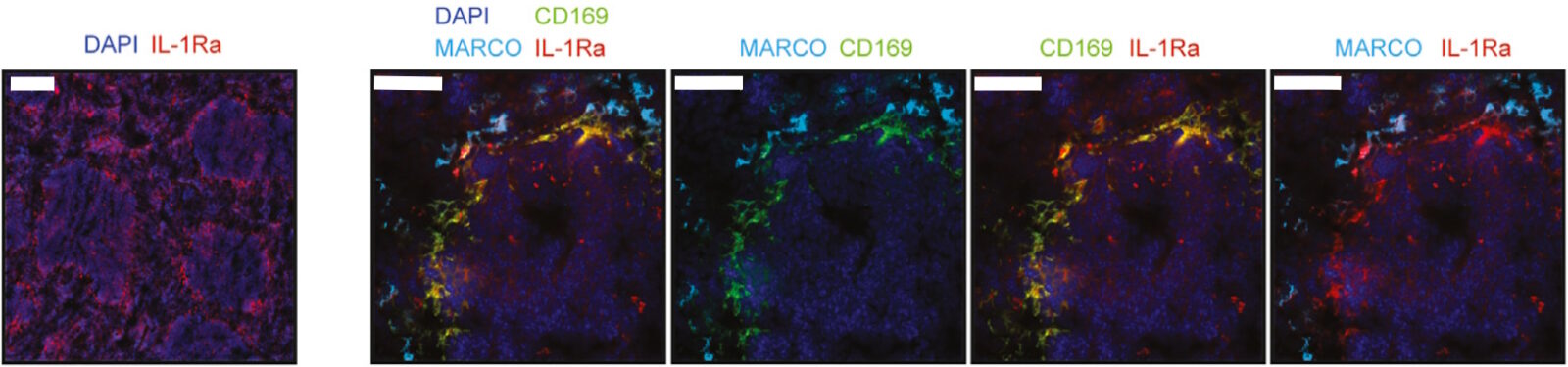 Spatial biology meets Candida albicans: deciphering infections, immune interactions, and ...