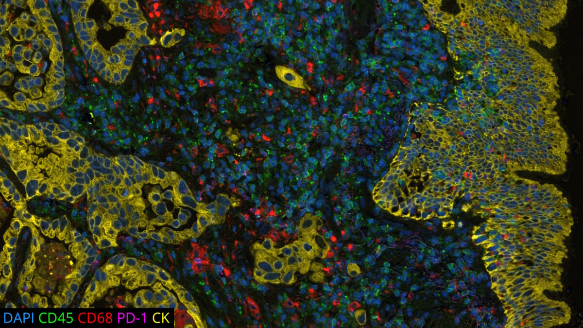 DAPI’s crucial role in multiplex immunofluorescence - Lunaphore ...