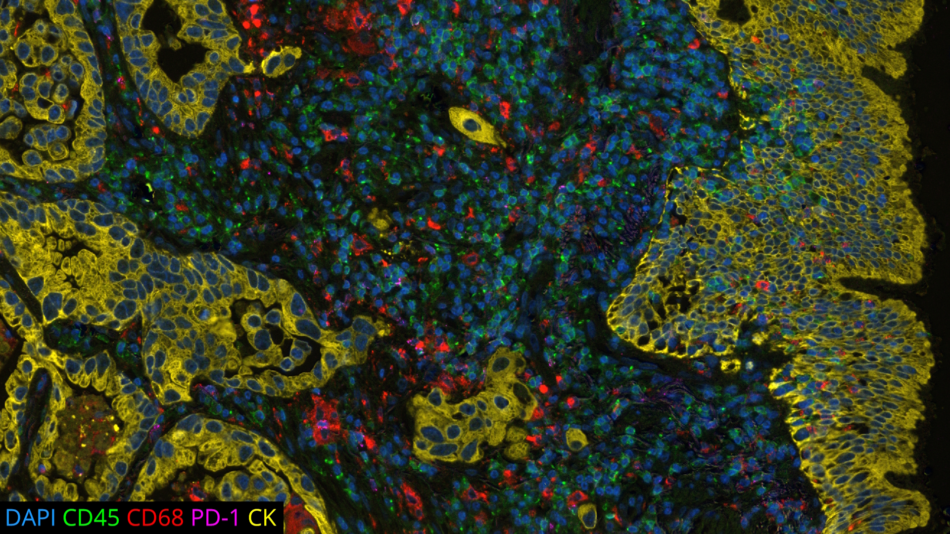 DAPI's crucial role in multiplex immunofluorescence - Lunaphore ...