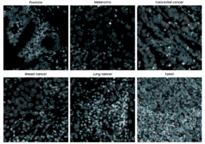DAPI’s crucial role in multiplex immunofluorescence - Lunaphore ...