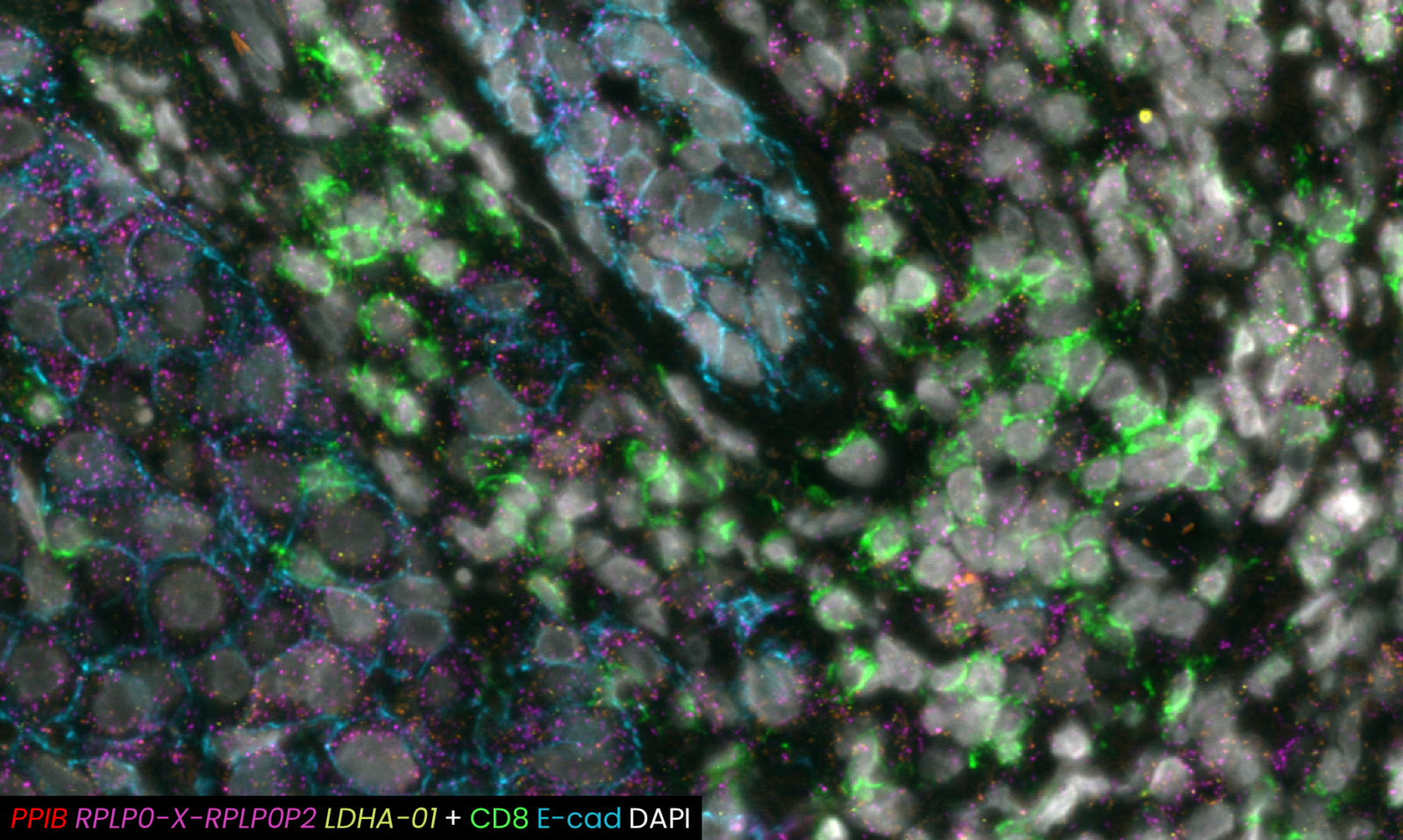 Putting the pieces together: the spatial evolution of cancer research ...